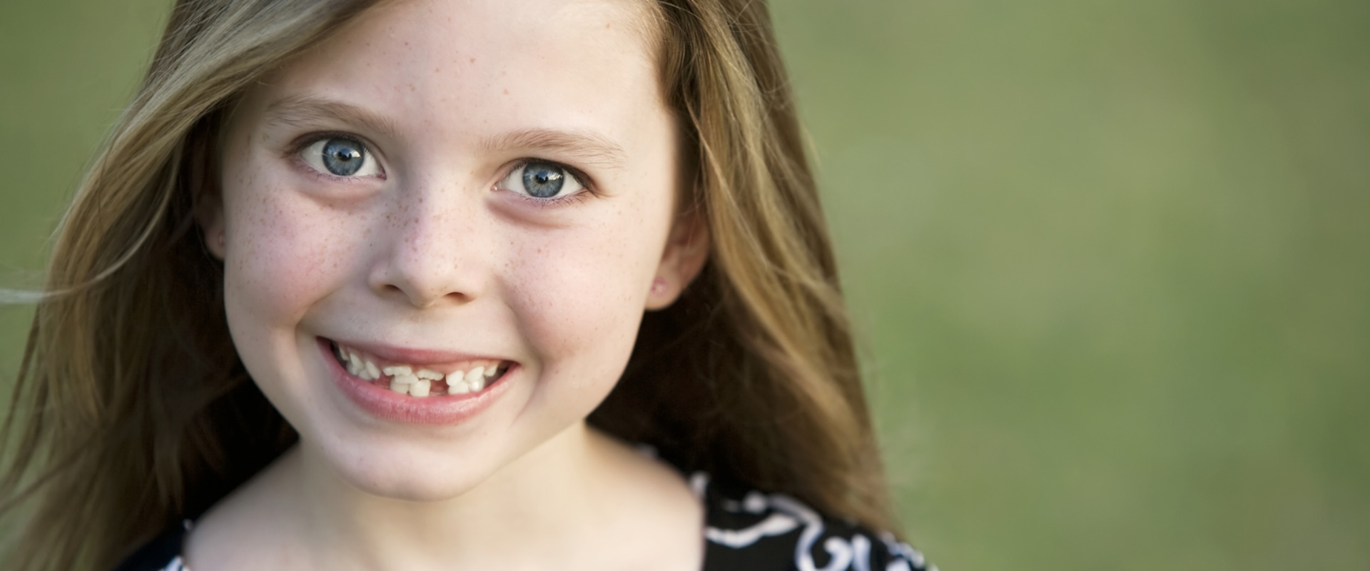 What are the Eight Bicuspid Teeth?